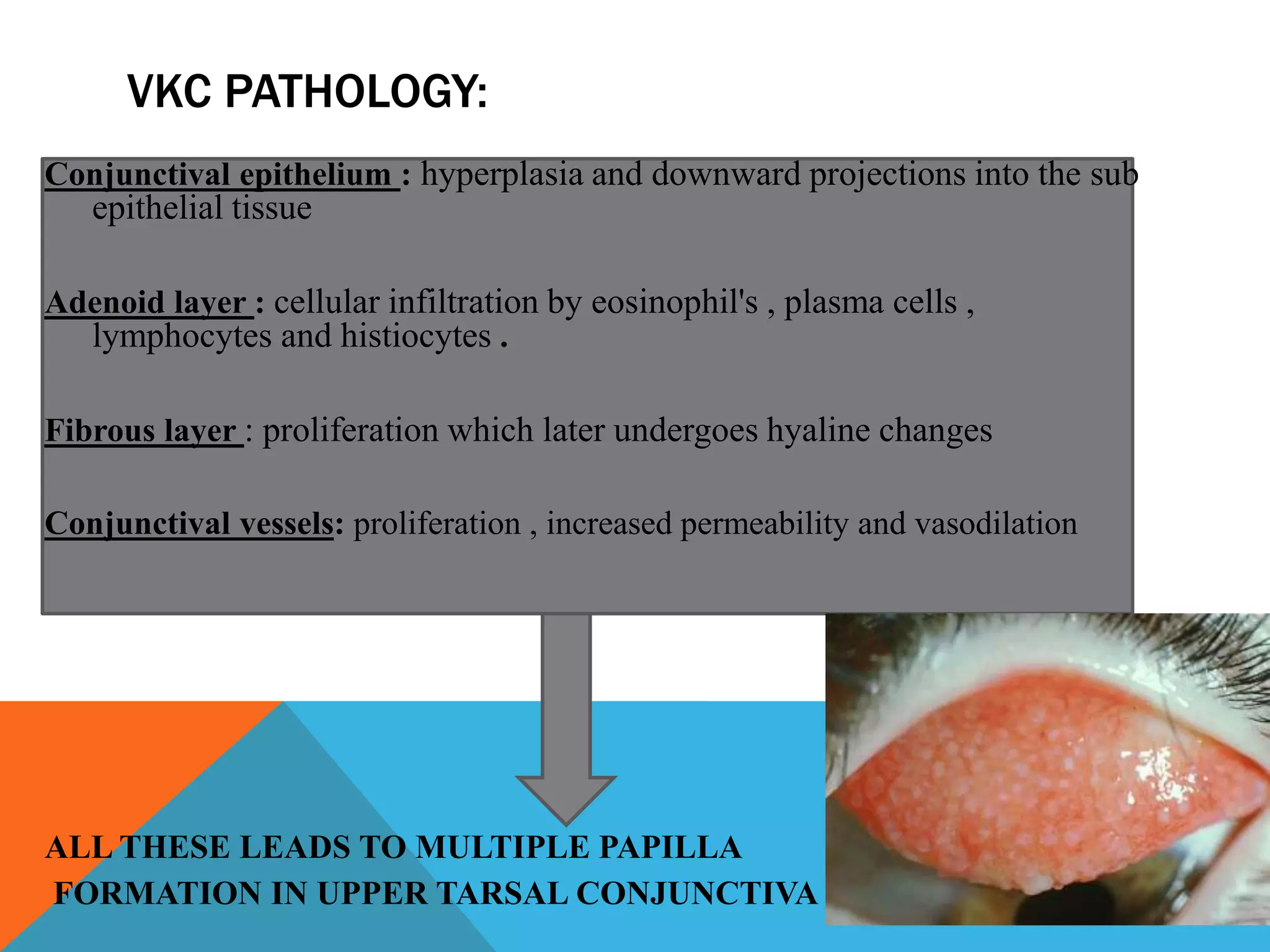 Allergic conjunctivitis | PPTX