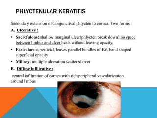 Allergic conjunctivitis | PPTX