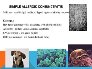 Allergic conjunctivitis | PPTX