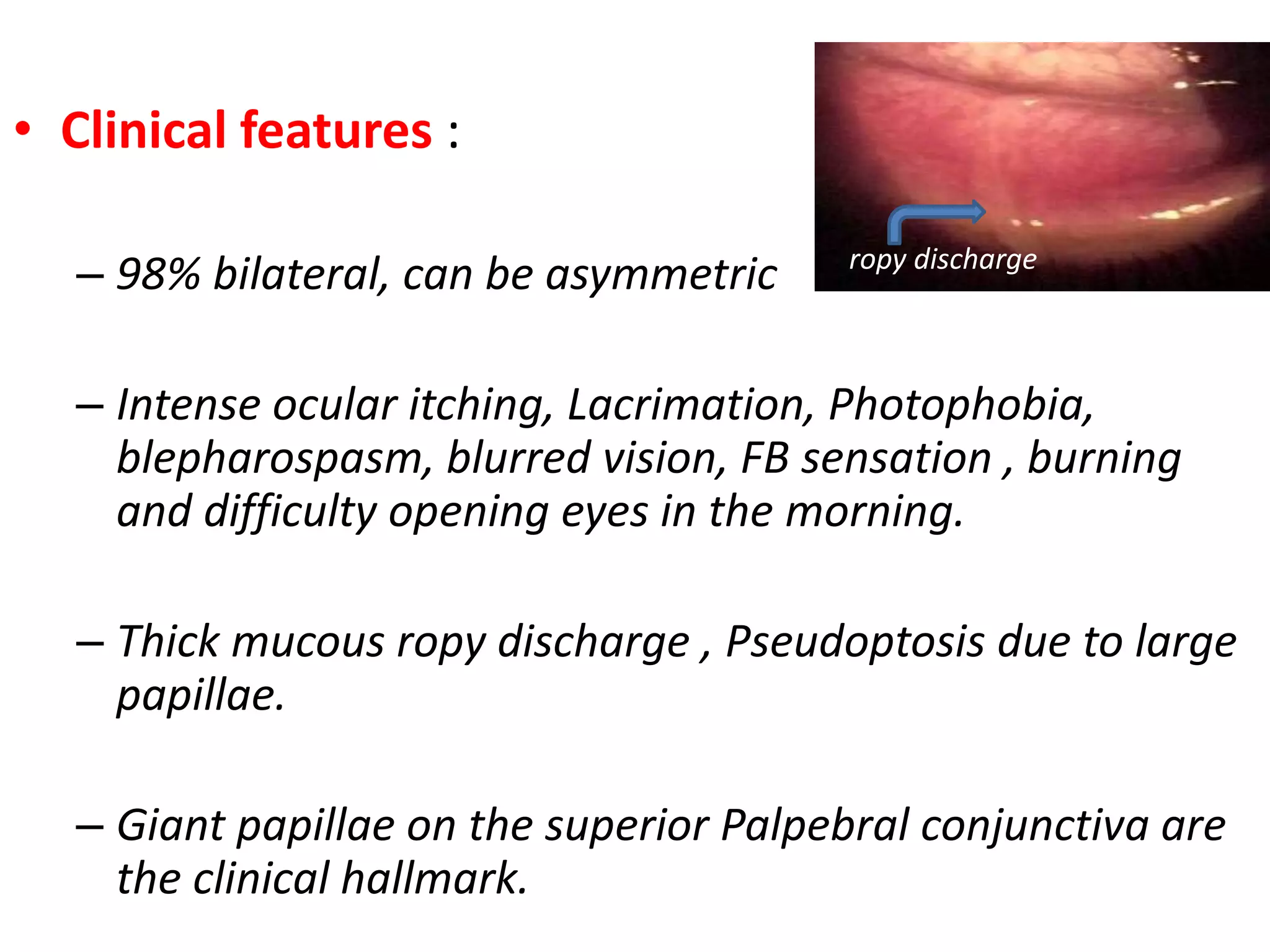 Allergic conjunctivitis | PPTX