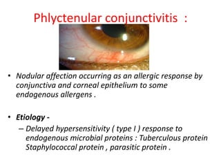 Phlyctenular Conjunctivitis