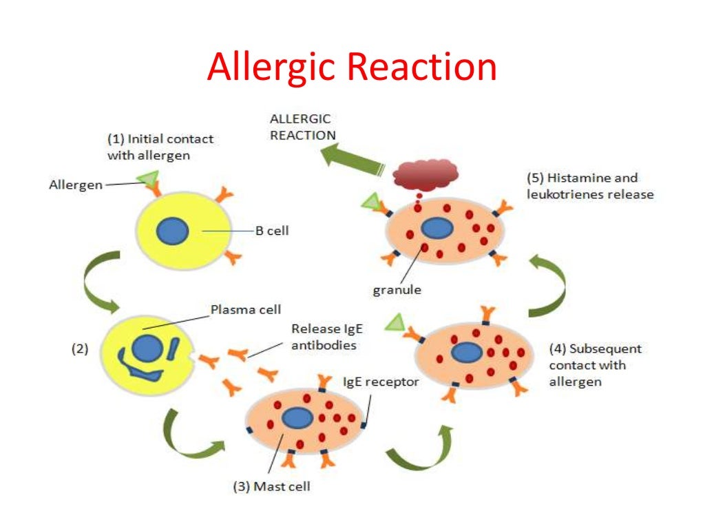 Allergic conjunctivitis