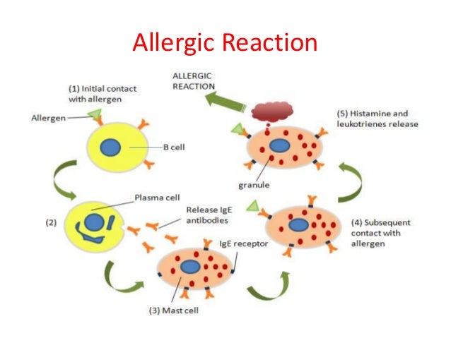 Allergic conjunctivitis