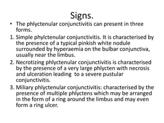 Allergic conjunctivitis | PPTX