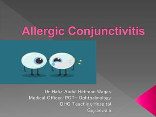 Allergic conjunctivitis | PPTX
