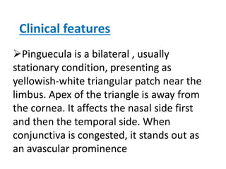 Allergic conjunctivitis | PPTX