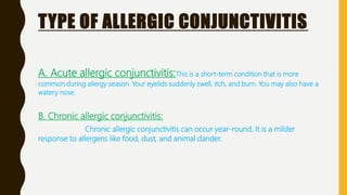 Allergic conjunctivitis | PPT