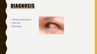 Allergic conjunctivitis | PPTX
