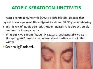 Allergic conjunctivitis | PPTX