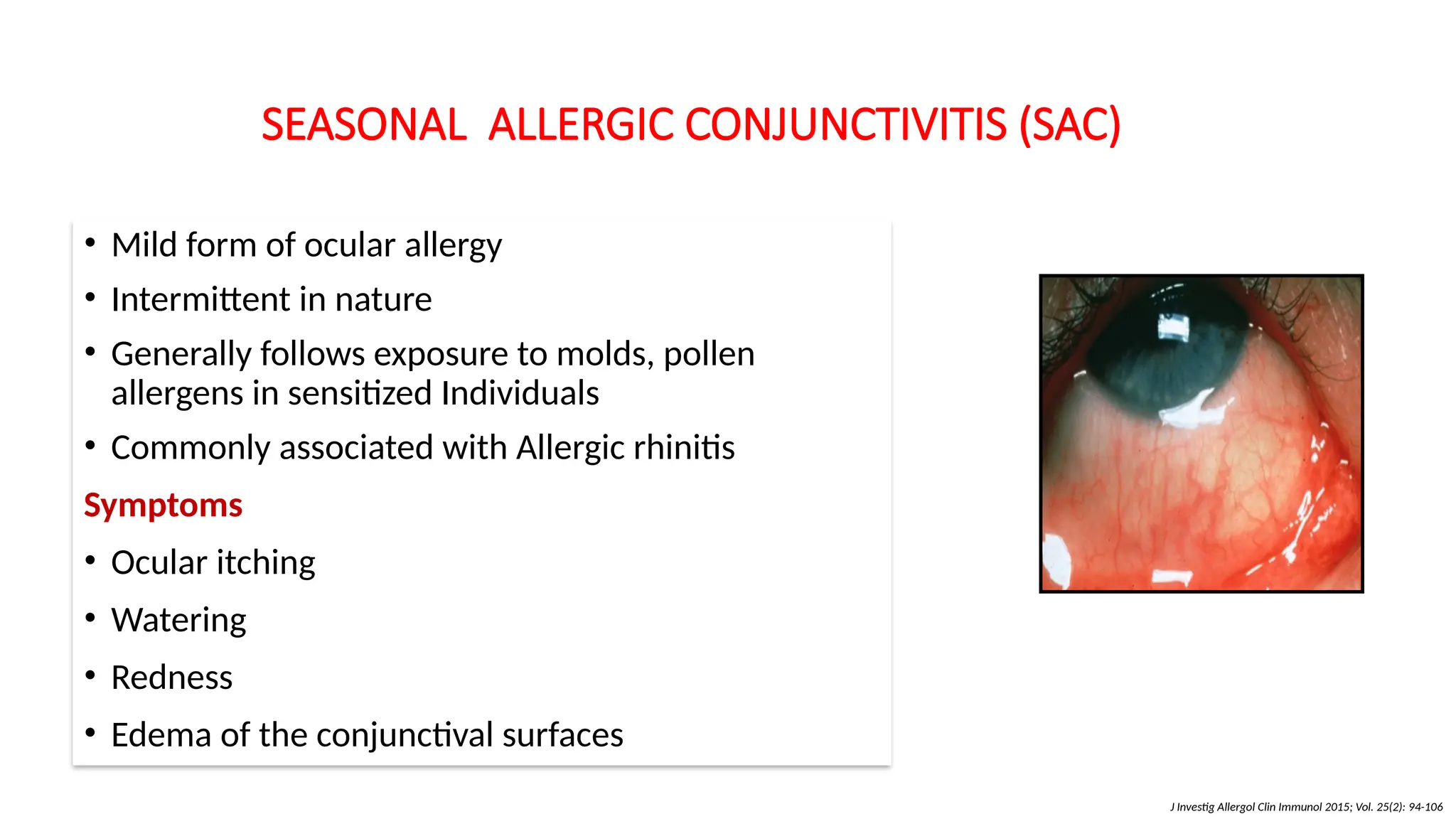 Allergic conjunctivitis management.pptx