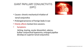 Allergic conjunctivitis management.pptx