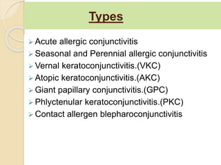 Allergic Conjuntivitis | PPTX