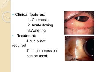 Allergic Conjuntivitis | PPT