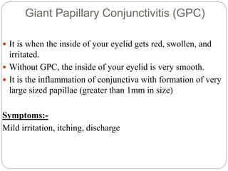 Allergic counjuctivitis | PPTX | Allergies | Diseases and Conditions