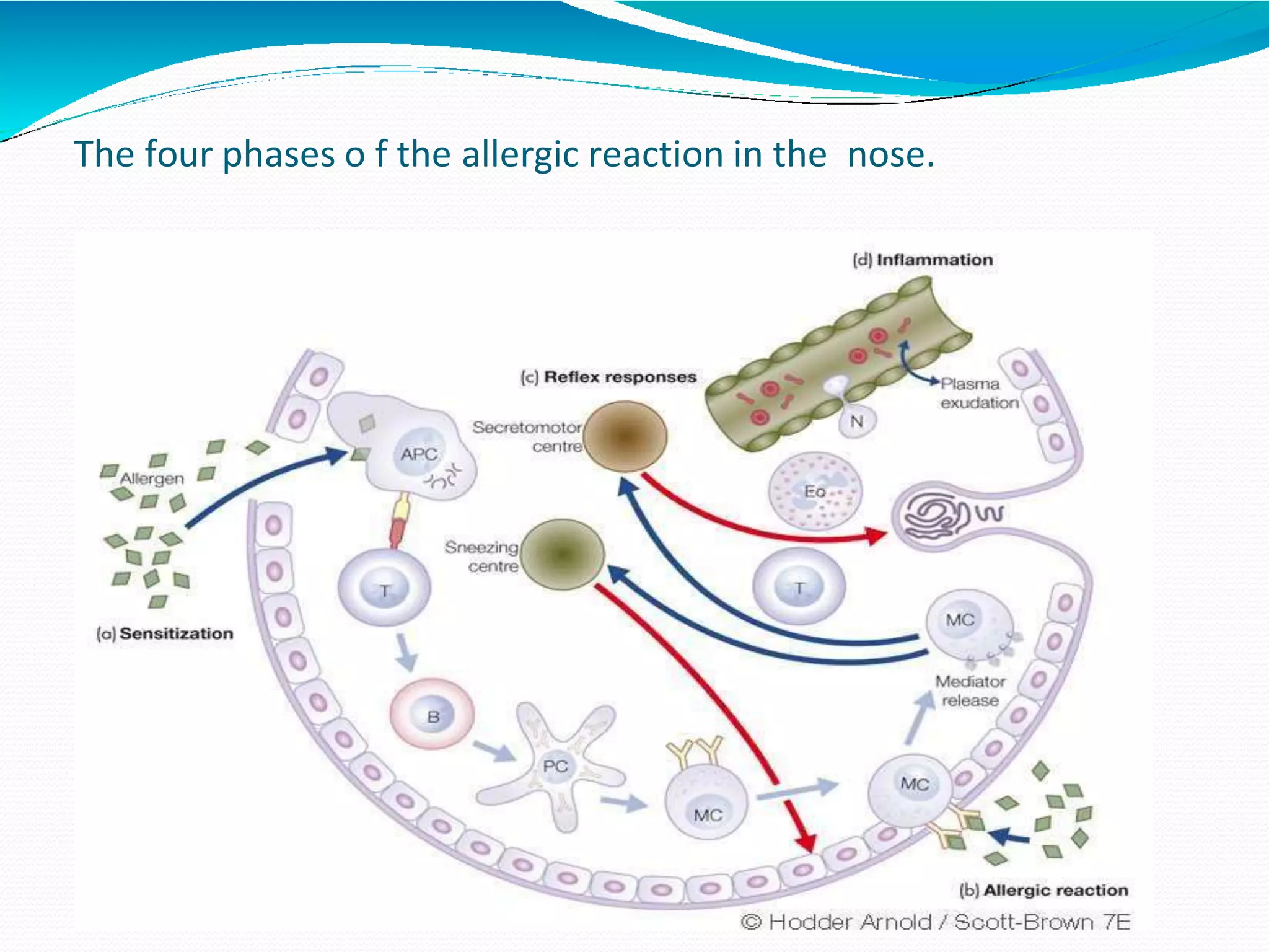 Allergic & Non allergic rhinitis.pptx
