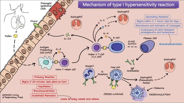Allergic or Hypersensitivity Reactions.pptx | Allergies | Diseases and ...