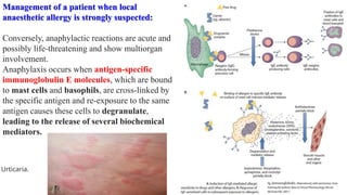 ALLERGIC REACTION OF LA.pdf