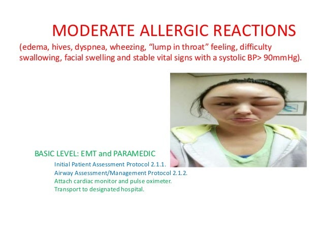 Mild Allergic Reaction On Face