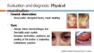 Allergic Rhinatis trearment and its effects | PPTX