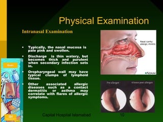 Allergic rhinitis | PPT | Allergies | Diseases and Conditions