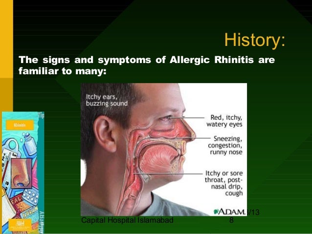 Allergic rhinitis