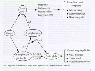 Allergic rhinitis | PPT