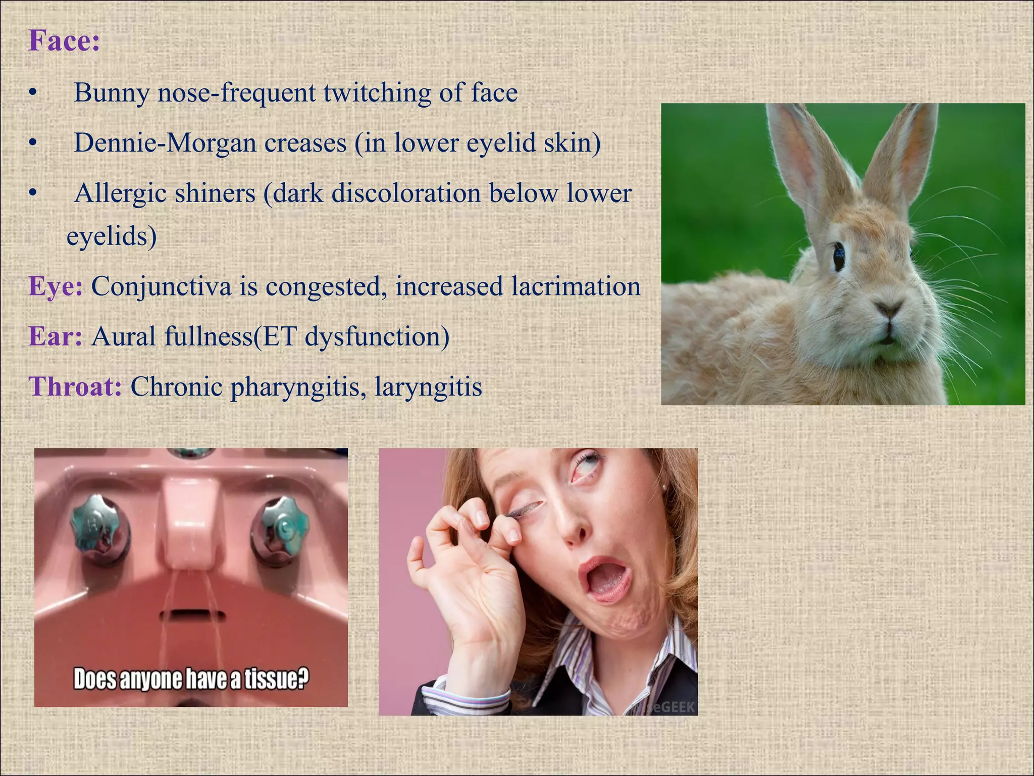 Allergic Rhinitis | PPT