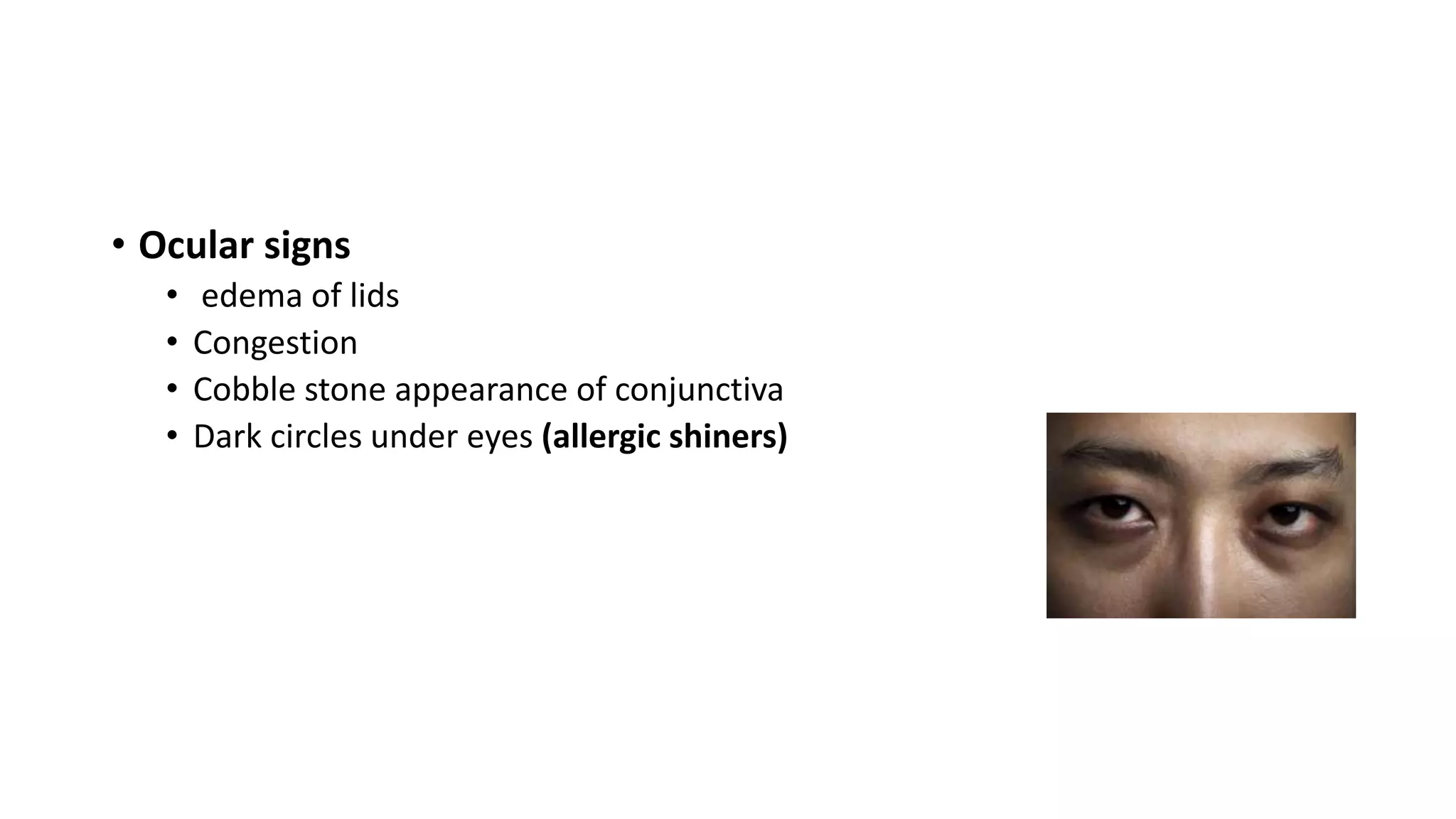 Allergic rhinitis symptoms signs treatment ent ppt | PPTX