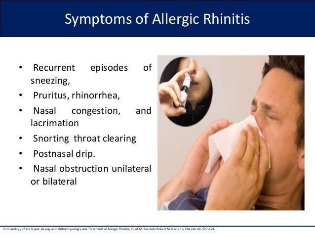 Allergic rhinitis