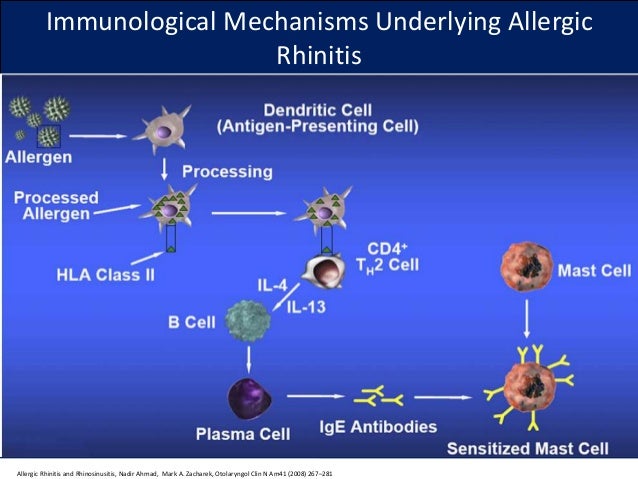 Allergic Rhinitis Pathophysiology