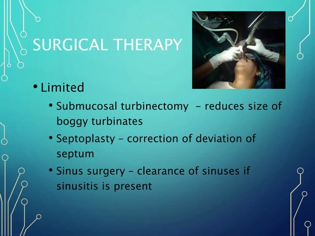 Allergic rhinitis - presentation | PPTX | Allergies | Diseases and ...