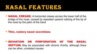 Allergic rhinitis. | PPT