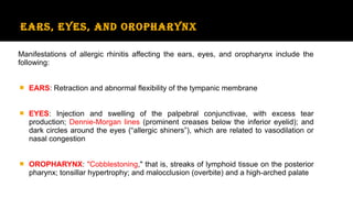 Allergic rhinitis. | PPT