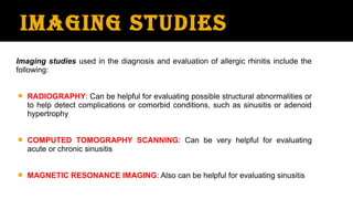 Allergic rhinitis. | PPT