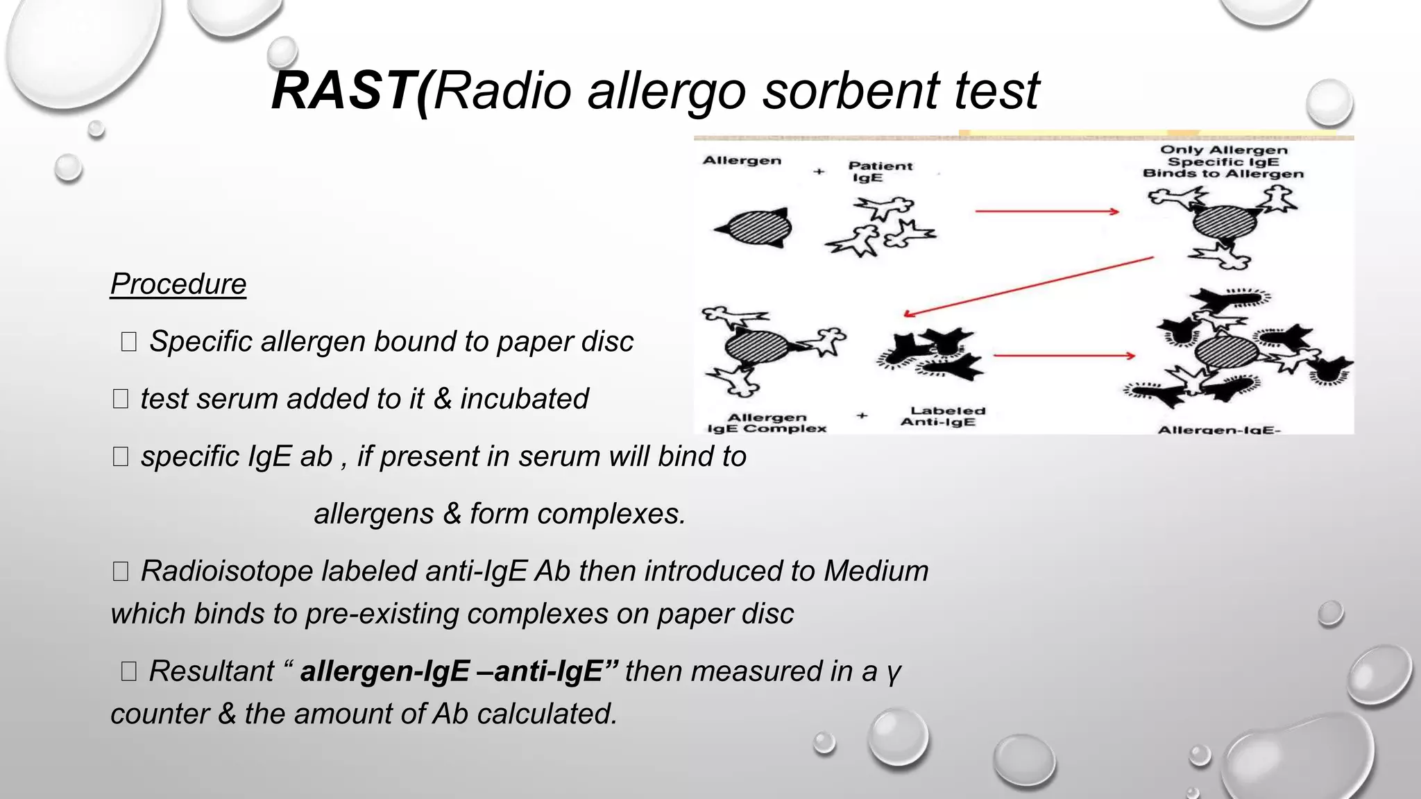 Allergic rhinitis | PPTX