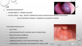 Allergic rhinitis | PPT