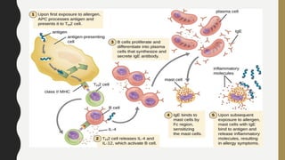 Allergic rhinitis | PPTX