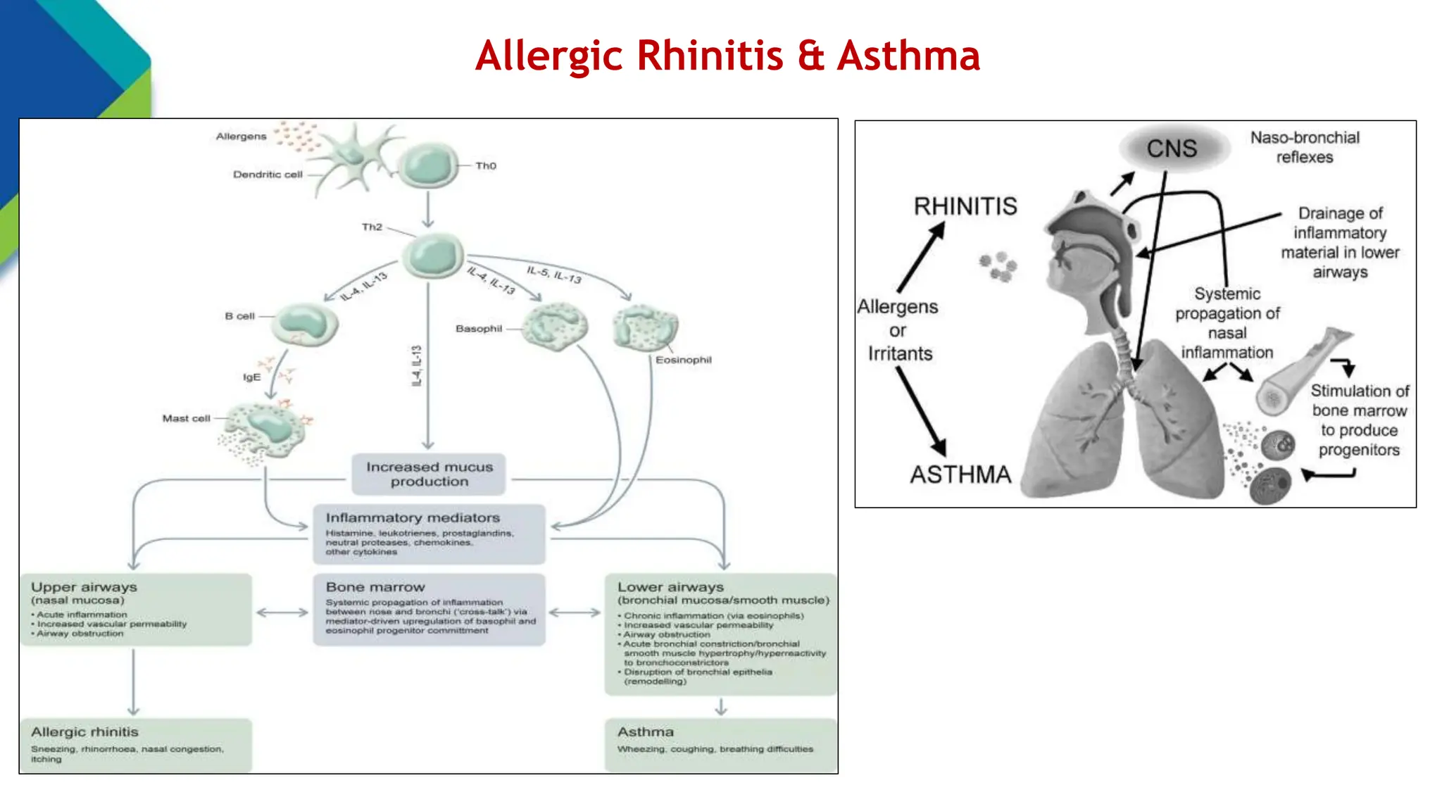 Allergic Rhinitis and Co-morbid Asthma.pptx
