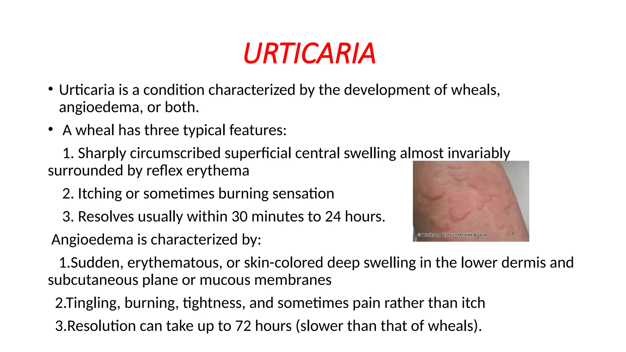 Allergic rhinitis ,Atopic dermatitis, urticaris | PPTX