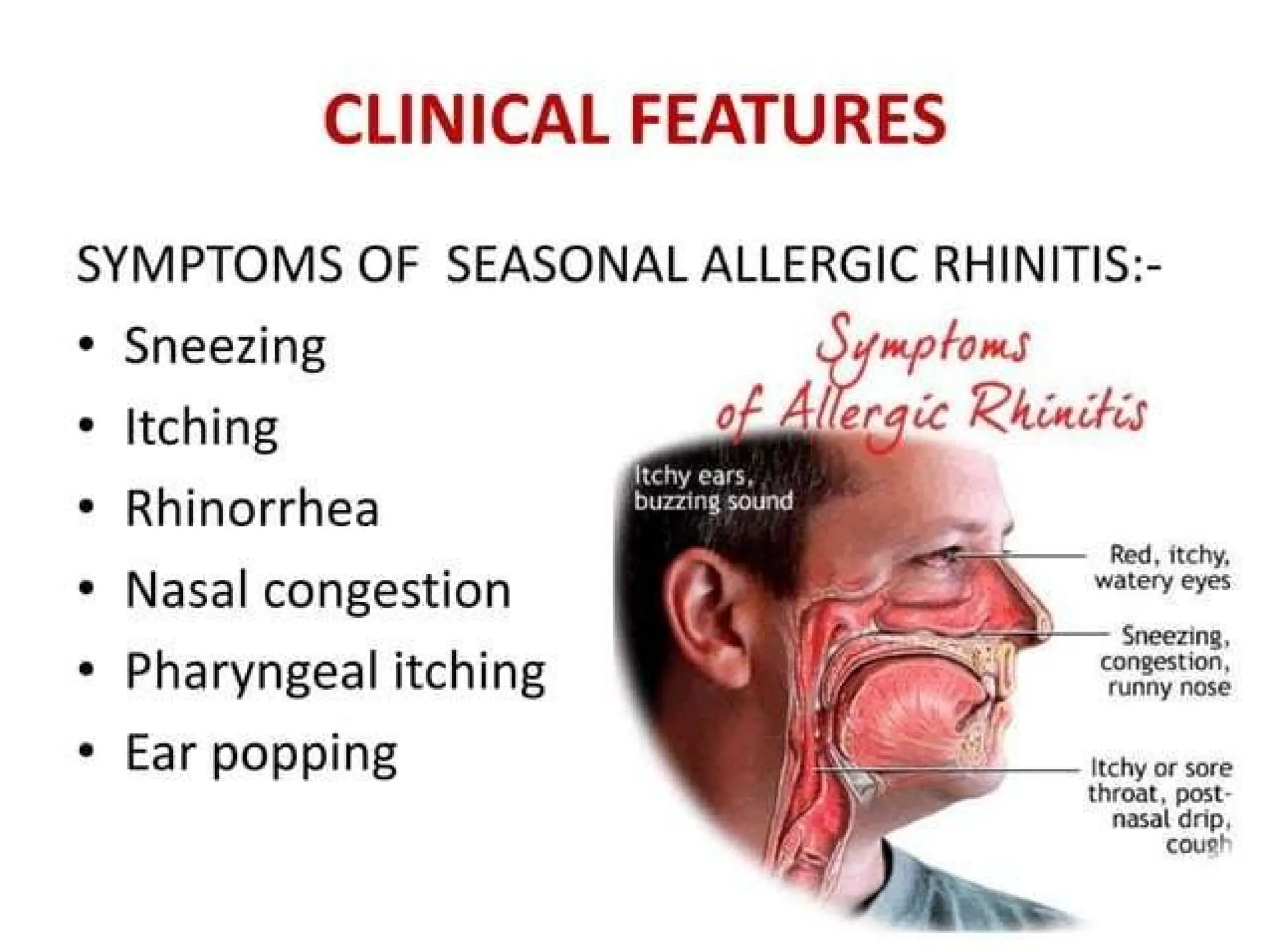 Allergic rhinitis in children in pediatric.pptx