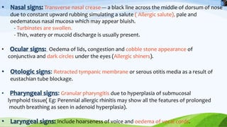 Allergic rhinitis ppt 2018 | PPTX