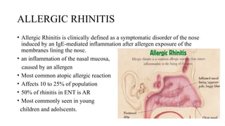 Powerpoint presentation on ALLERGIC RHINITISs.pptx