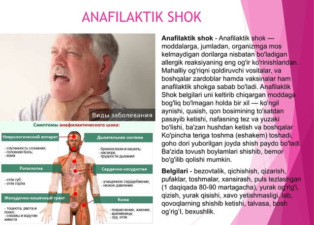 allergik kasalliklar 000127374445555555554443332222222.pptx