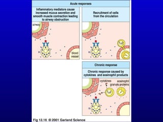 Allergy and Hypersensitivity | PPT