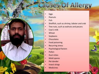 Allergy | PPTX