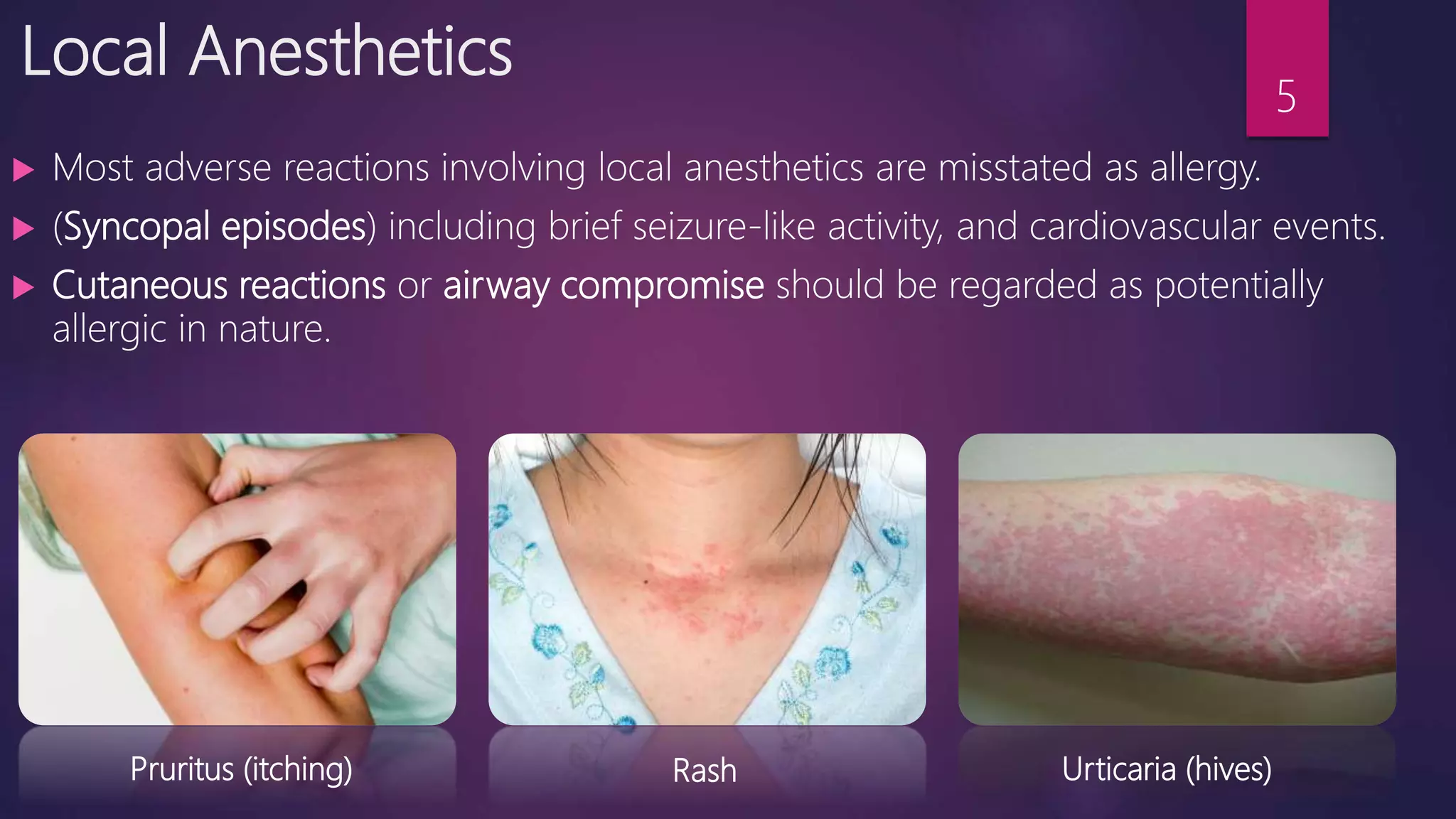 Dental Managment Of Allergy | PPTX