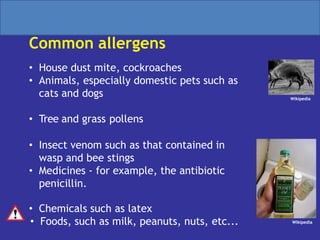 Allergy.pptx
