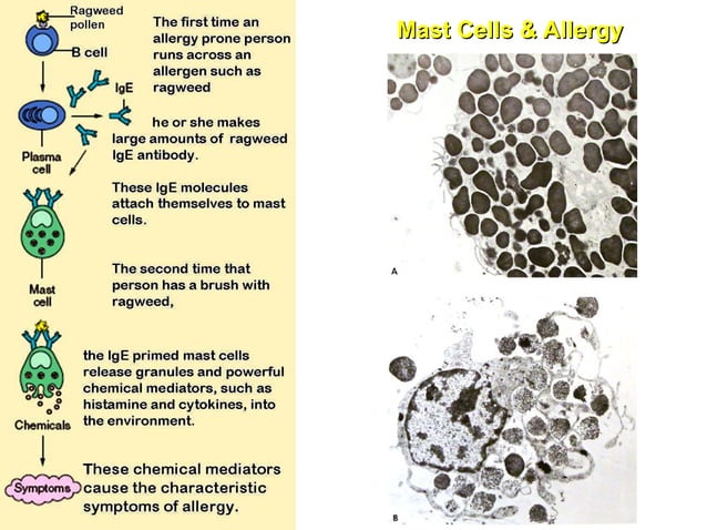 allergy and hypersensitivity pdf download | PPT