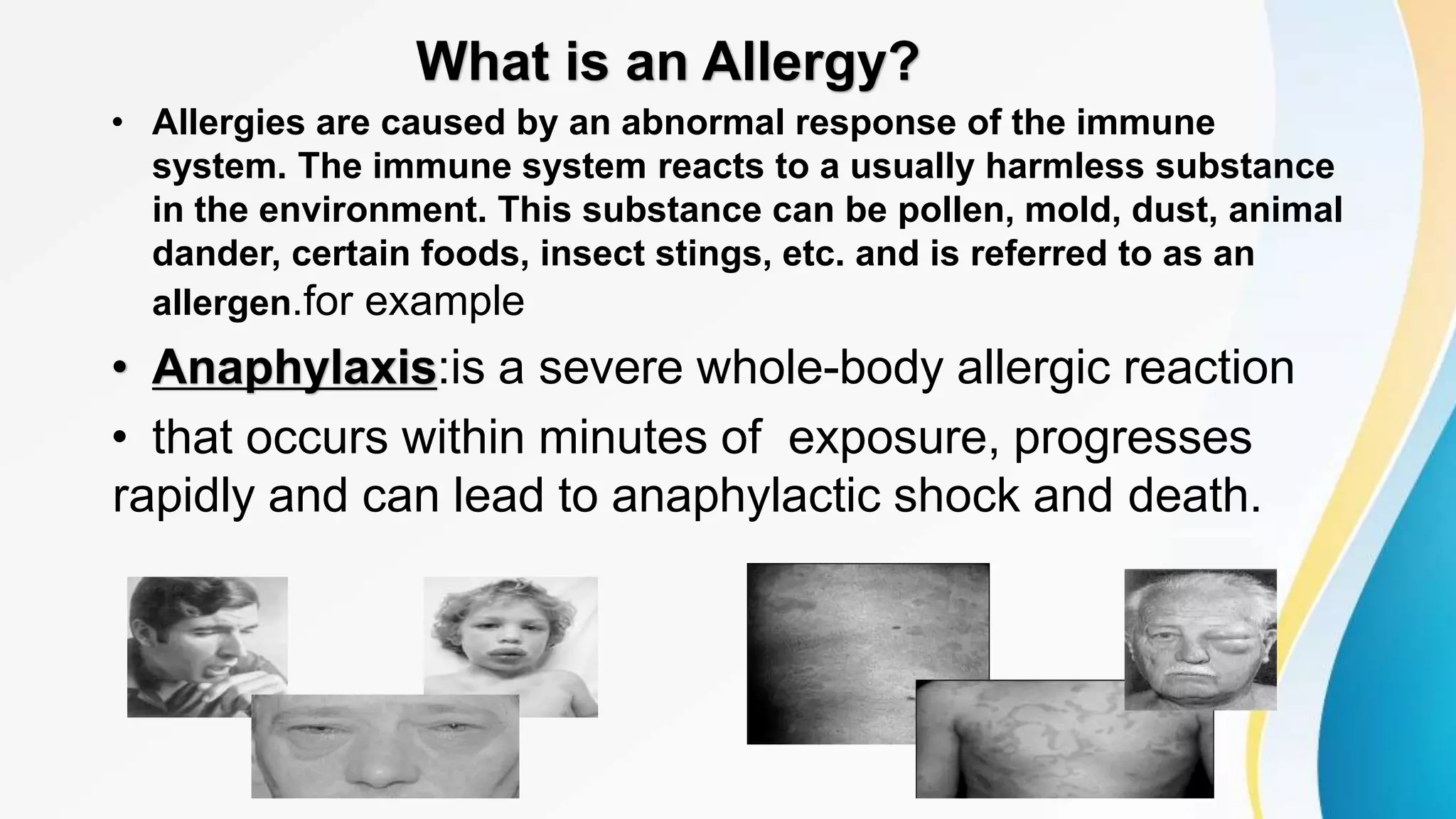Allergy and histamine | PPTX