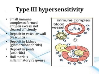 Allergy and hypersensitivity | PPTX